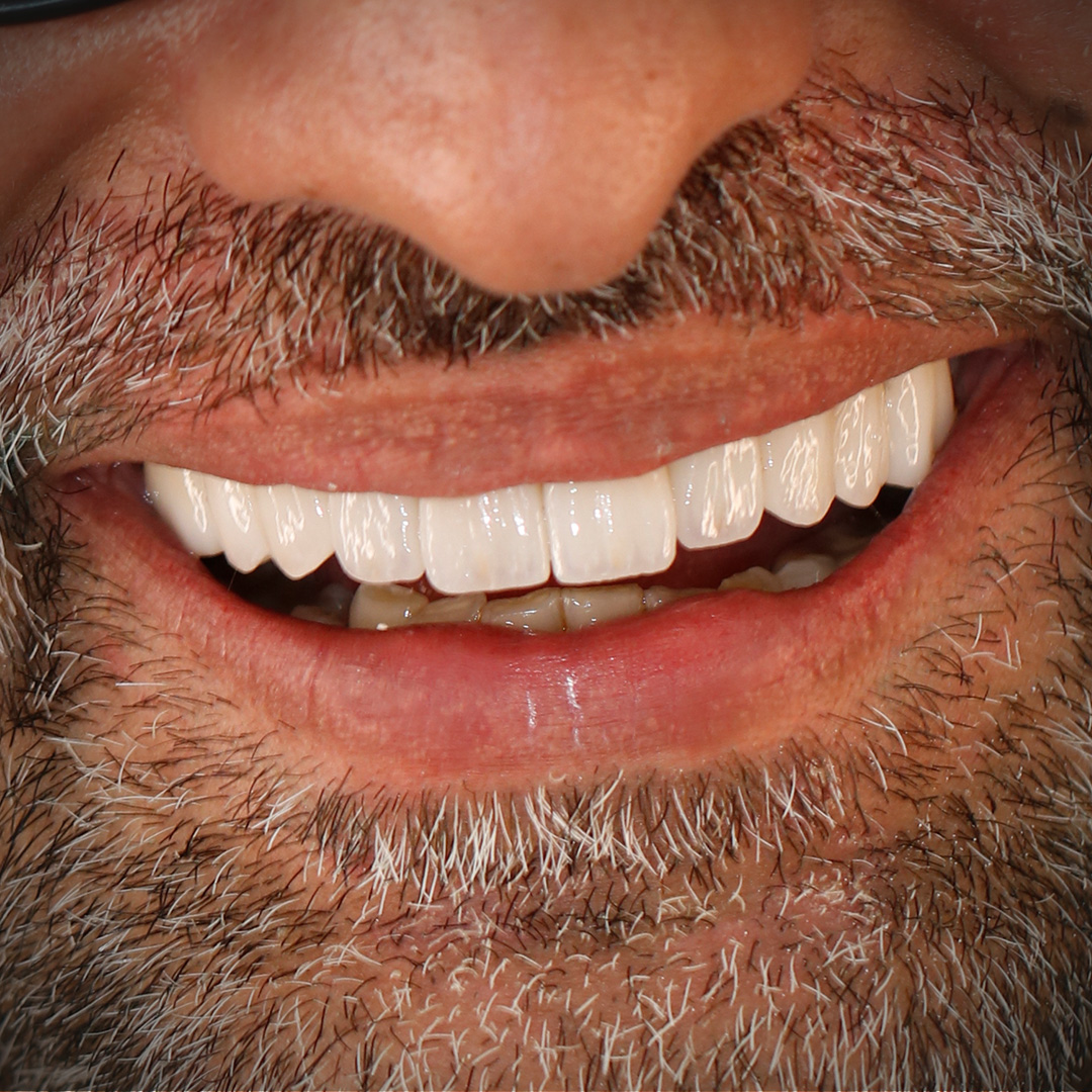 Maya Smile Club - MAYADENT