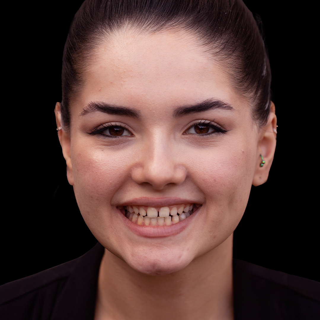 Before & After - MAYADENT