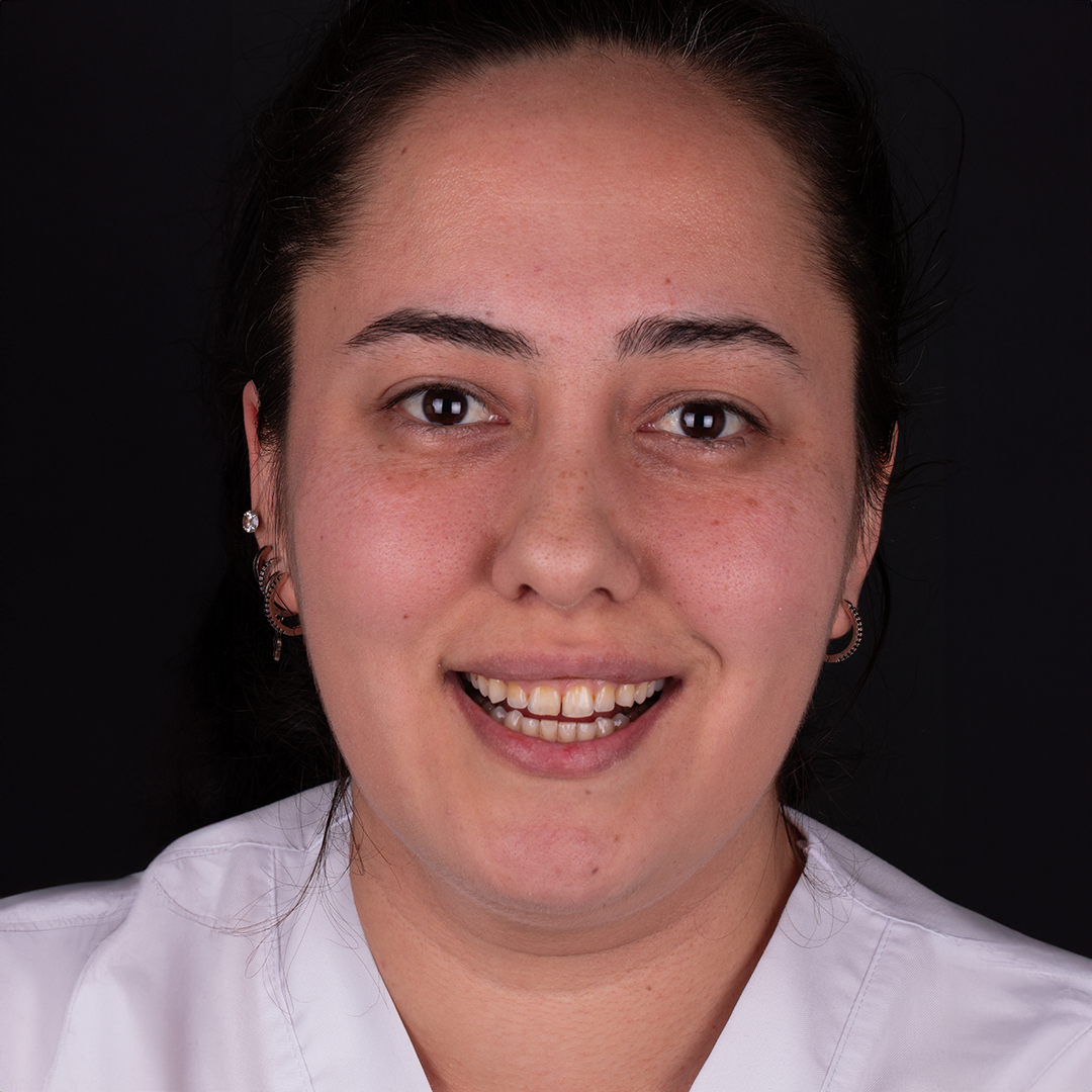 Before & After - MAYADENT